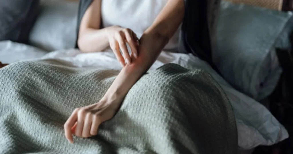 Urticaire ? Allergie ? Tout son corps la démangeait, les médecins ...